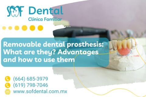Removable dental prosthesis: What are they? Advantages and how to use ...